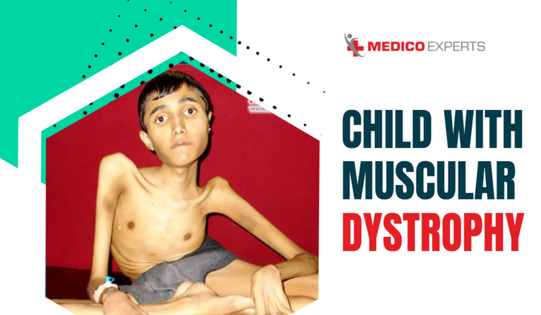 Early Signs of Muscular Dystrophy: A Guide for Parents | Medico Expert