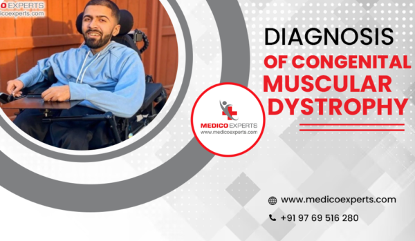 Congenital Muscular Dystrophy Causes & Symptoms Explained